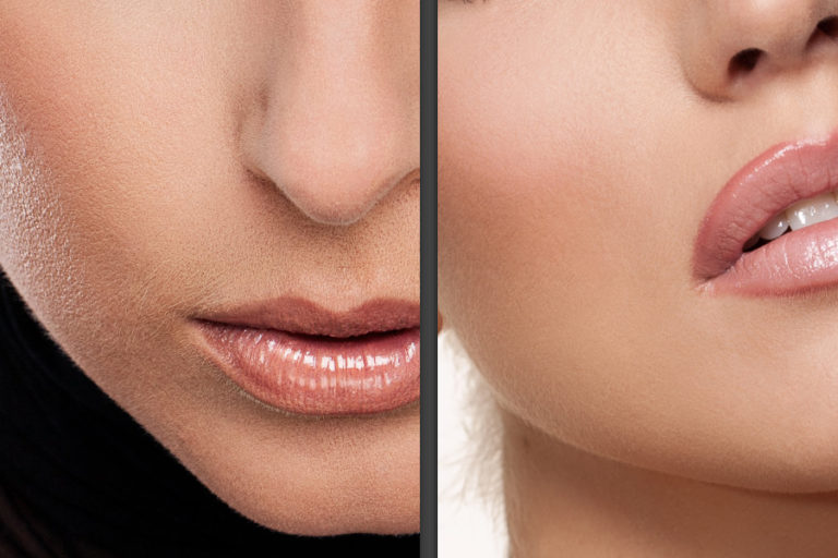 add texture to skin in photoshop- rephotosolution.com