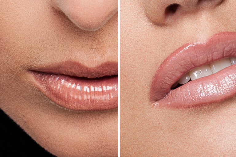 add texture to skin in photoshop- rephotosolution.com