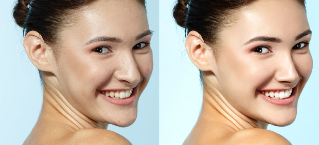 10 skin retouching photoshop tutorials- rephotosolution.com